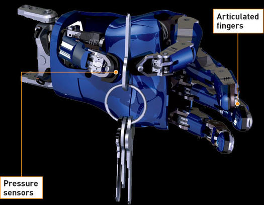 Myoelectric Prosthesis